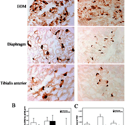 Comparision of NMJs from different muscles.