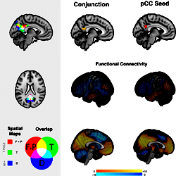The posterior cingulate cortex is a hub integrating different forms of ...
