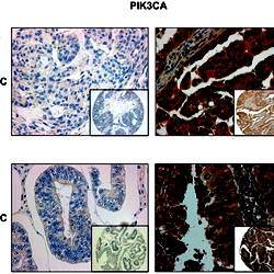 Immunostaining analysis of PIK3CA in OC.