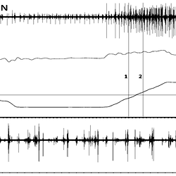Examples of ISO, CON and ECC trials from one subject at 10% MVC.