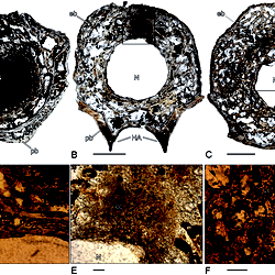 Vertebral histology of Chroniosaurus dongusensis (Chroniosuchia ...