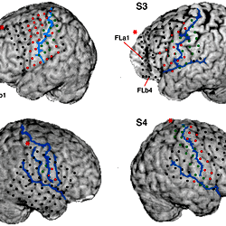 Locations of ECoG grid electrodes in relation to the cortex.