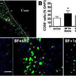 Bone fracture increased CD68+ macrophages in the peri-infarct region.