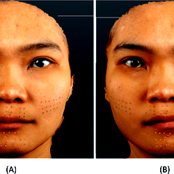 The Accuracy of Conformation of a Generic Surface Mesh for the Analysis ...