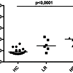 Soluble CD25 concentration.