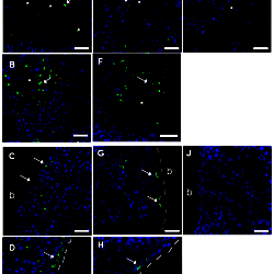 Intrafemoral transplantation of MSCs into immunodeficient NSG mice.