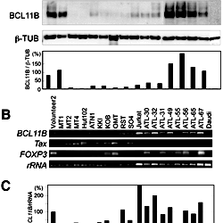 A comparative analysis of the BCL11B protein and mRNA expression levels.