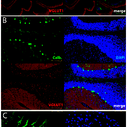 Calbindin staining in cerebellum of late stage 22L-animals highlights ...