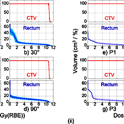 Averaging dose volume histogram (DVH) graphs of rectal dose and CTV dose.