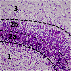 Histological abscess layers.