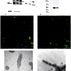 Polycystin-1 expression and staining in RPTEC, NHPTK and PKD Q4004X cells.