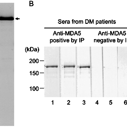 Purity and antigenicity of recombinant GST-MDA5 protein.