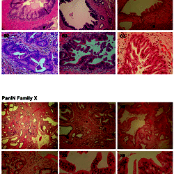 Histology of PanIN lesions.