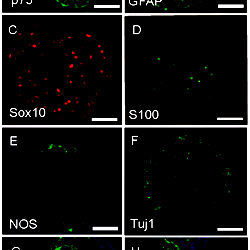Expression of progenitor, glial and neuronal markers by mouse ...