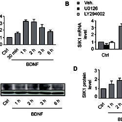 BDNF enhances the expression of SIK1 through the MAPK signaling pathway.