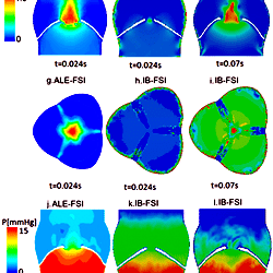 Fluid-Structure Interaction Simulation of Prosthetic Aortic Valves: Comparison between Immersed ...