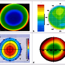 Representation of aberration maps with all four devices.