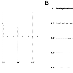 Quantitative measurement of metamorphopsia using M-CHARTS in eyes with ...