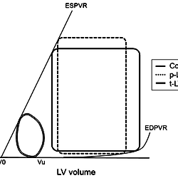 Theoretical analysis of the impact of left ventricular assist device ...