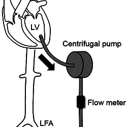 Diagram of the left ventricular assist device (LVAD) used in this ...