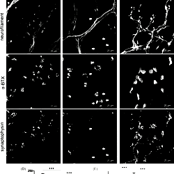 Severe denervation of FDB-2muscle in severe SMA mouse is restored by MO ...