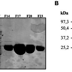 Protein identification.
