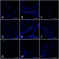 Confocal immunofluorescence staining.