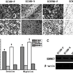 Expression of SDR9C7 correlated with the invasive potential of ESCC ...