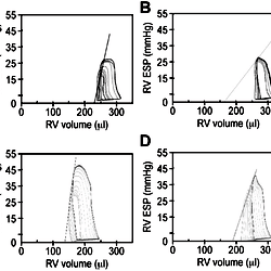 Right ventricle (RV) pressure-volume (PV) loops.