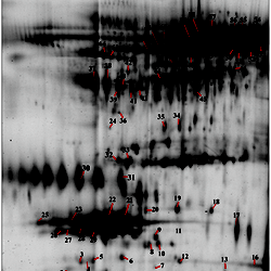 Tear protein profile showing the annotations of the identified tear ...
