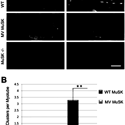 Effect of the MV MuSK mutation on AChR aggregation.