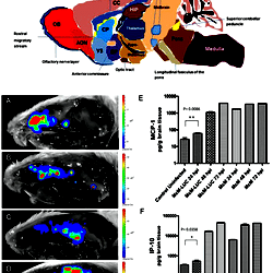 Schematic depiction of anatomical organization of mouse brain in medial ...
