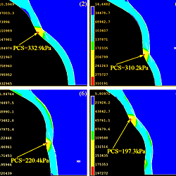 Summary of the Cap Stress in Eight Idealized Models with Non-linear ...