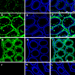 The expression of Venus protein in epididymis from three SB transgenic ...