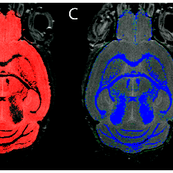 Native space images from the library for a single brain.