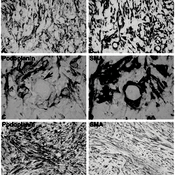 Examples of the "diffuse" pattern.