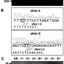 APOL1 null alleles in 51 participants.