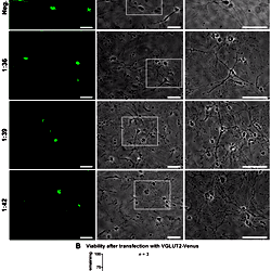 Decreased cell viability after VGLUT2-Venus transfection using the NTS ...
