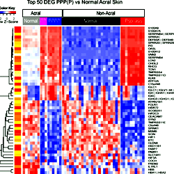 Heat map representing the expression profiles of the top 50 ...
