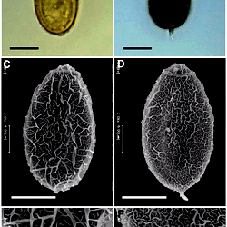Abopercular knob of normal and cultured C. sinensis eggs.