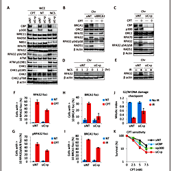 Impairment of RPA foci formation and the DNA damage checkpoint in CBP ...