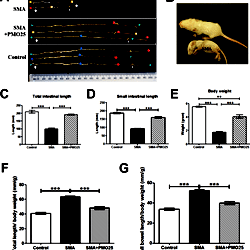 Gross anatomical features of the bowel in SMA, control and PMO25 ...