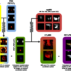 Step-by-step illustration of the rigid registration algorithm.