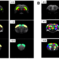 Regions of interest (ROIs) used in connectivity analysis.