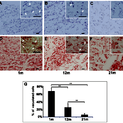 Histological characterization of NP tissue from IVD of rats at ...