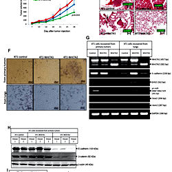 Wnt7A is regulated by Grhl2, and over-expression of Wnt7A ...