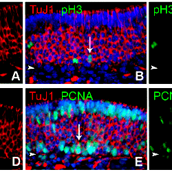 A subset of TuJ1(+) cells are proliferating.