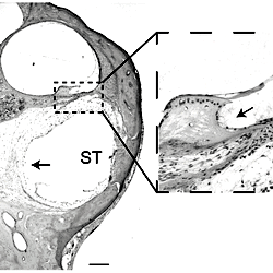 Histological sections showing an example of tissue response in the ...