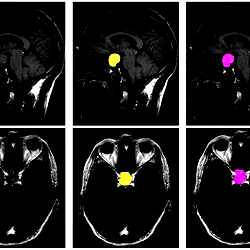 These screenshots present segmentation results on a sagittal (upper row ...