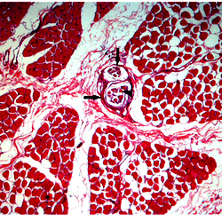 Light microscopic views of muscle spindles in the OP.